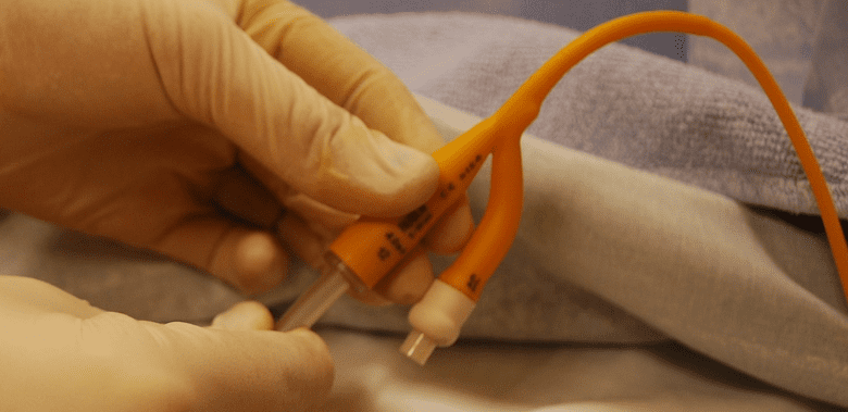 plastic tube cover -NANOVEA